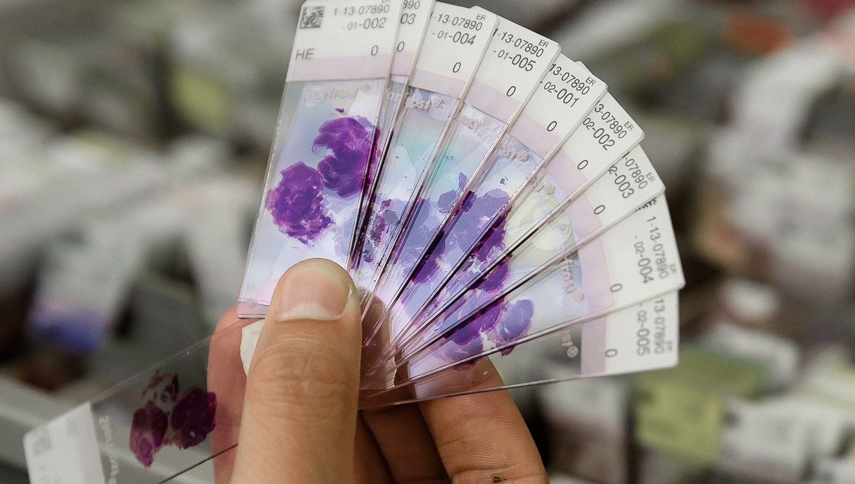 Next Gen AI Powered Diagnostics Could Help Usher In Precision Medicine ...